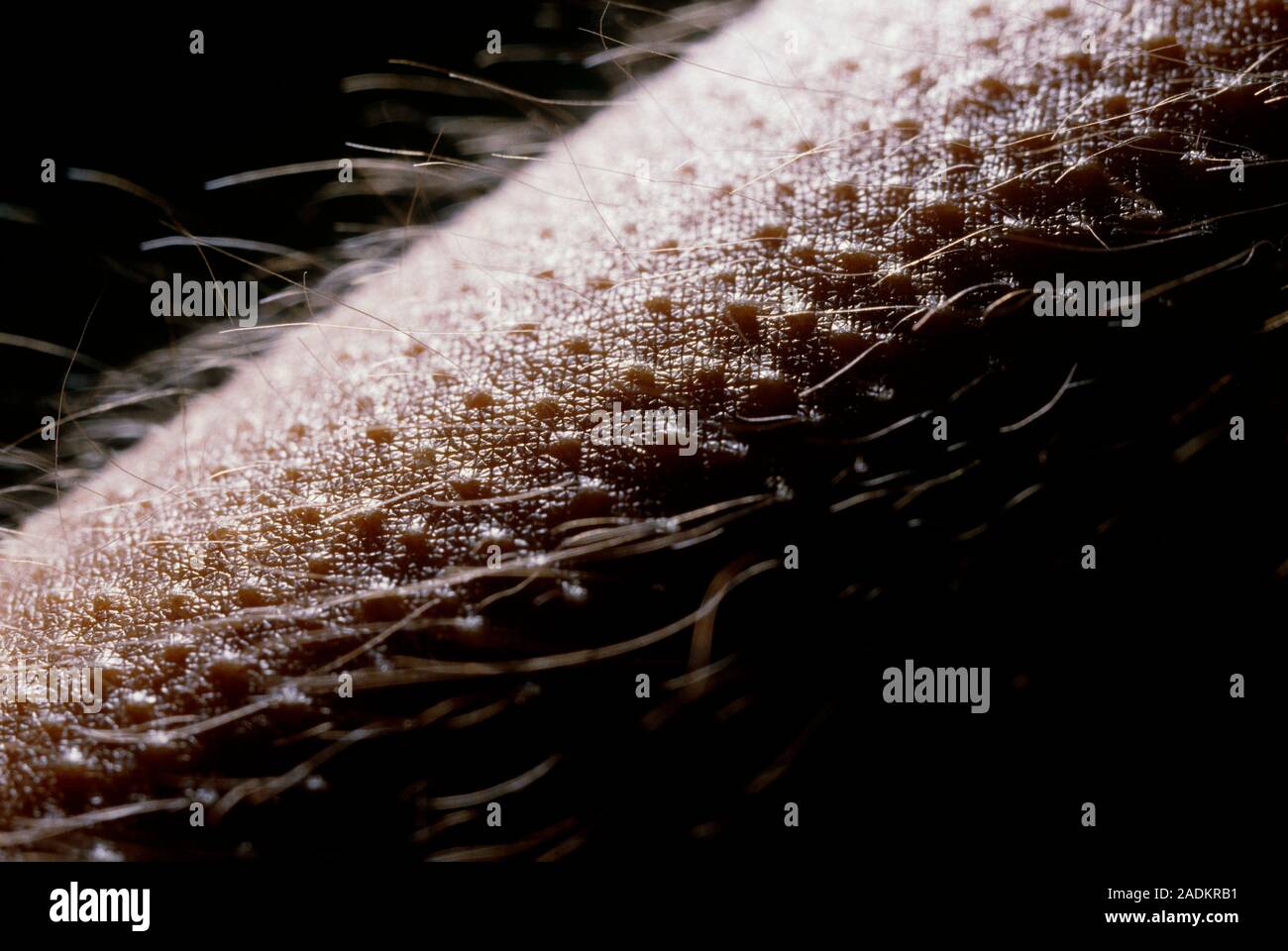 Macrophotograph of the skin on the arm of a young male human showing ...