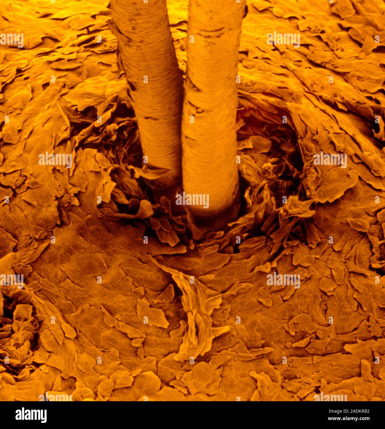 False-colour scanning electron micrograph (SEM) of the surface of skin ...