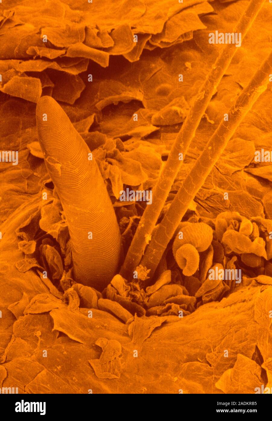 False-colour scanning electron micrograph (SEM) of the surface of skin ...