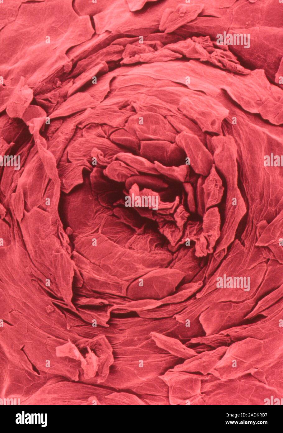 Sweat pore. Scanning electron micrograph (SEM) of a sweat pore in the ...