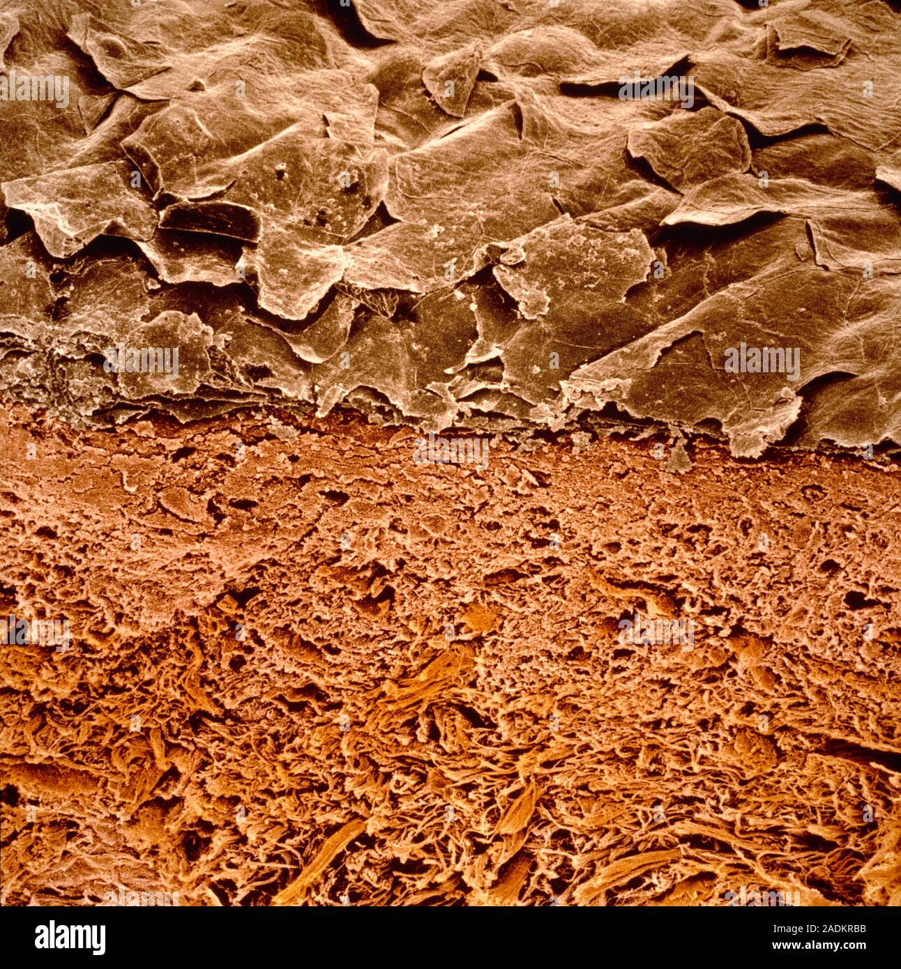 False-colour scanning electron micrograph of a section of human skin ...