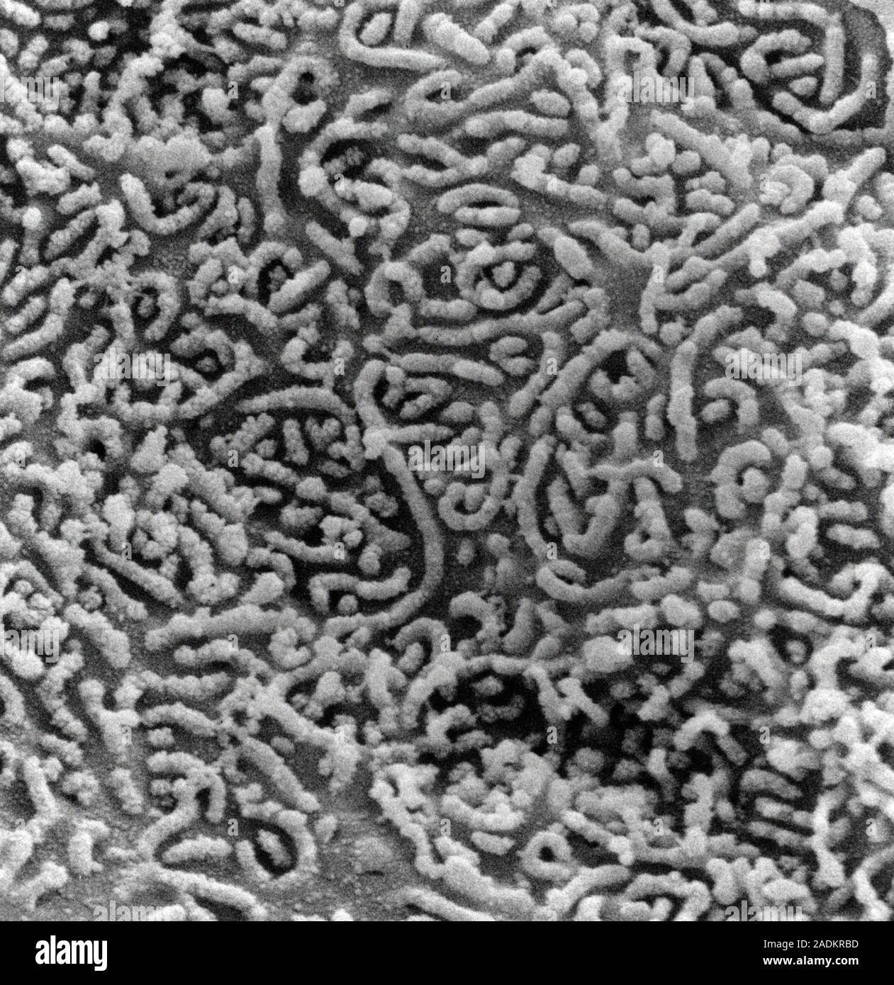 Scanning electron micrograph of the surface of a cell from an ...