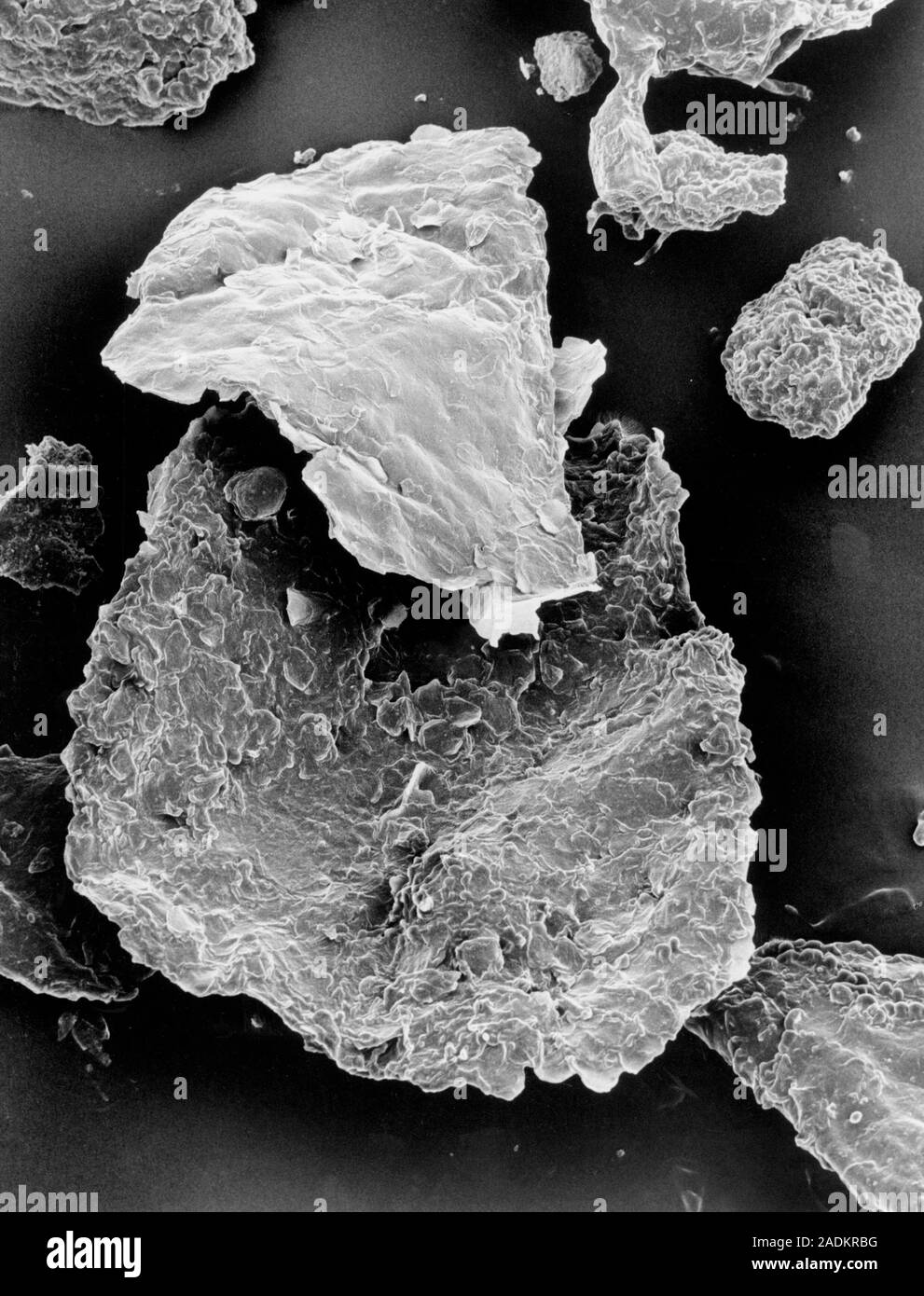 Scanning electron micrograph (SEM) showing human skin scales from a ...