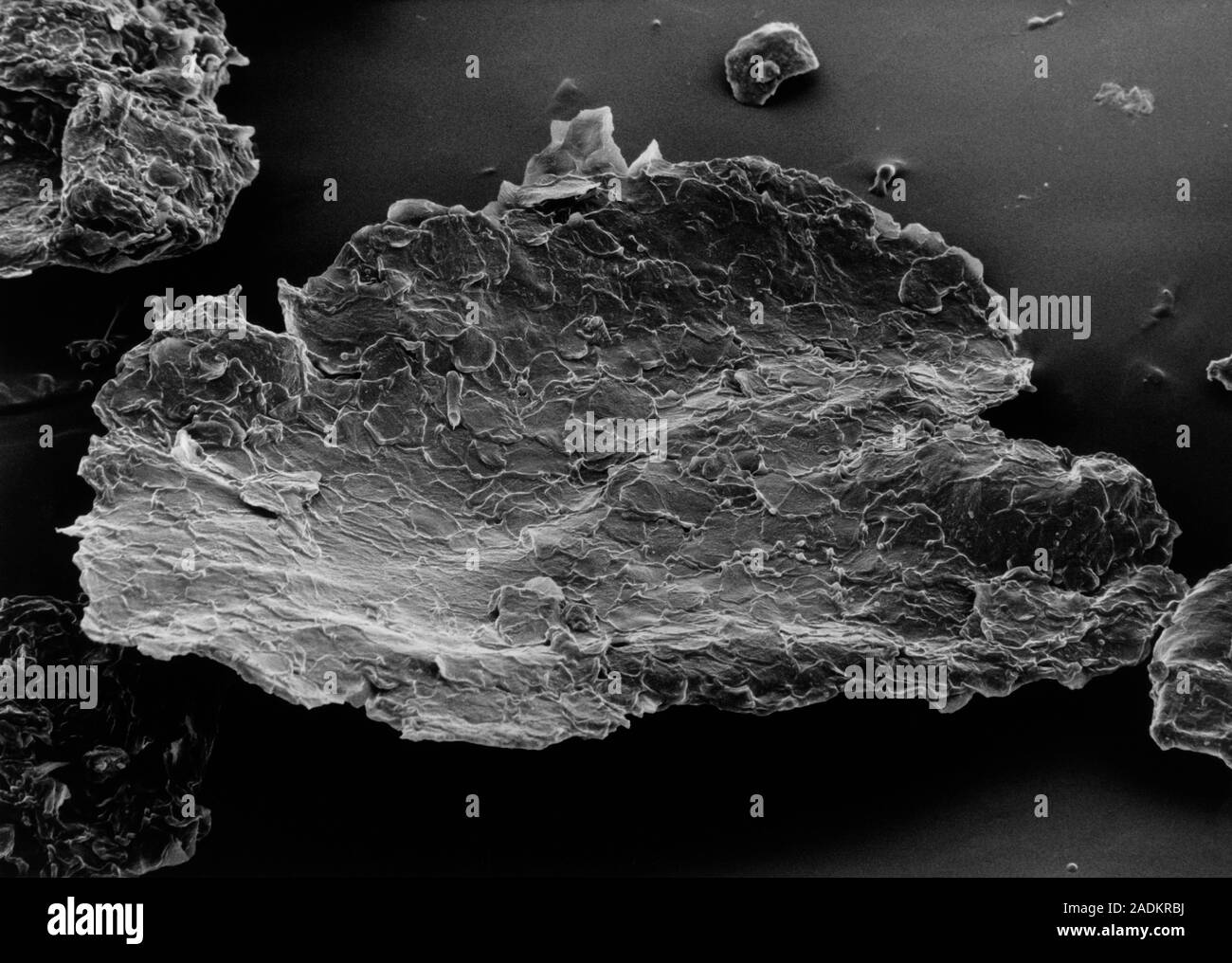 Scanning electron micrograph showing a human skin scale from a mild ...