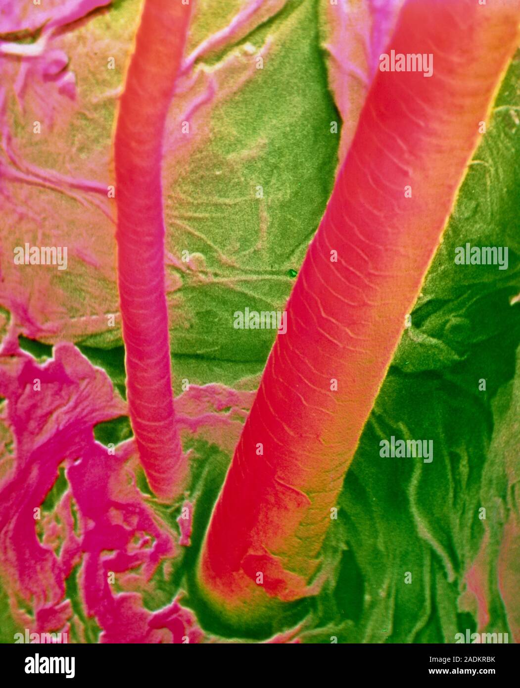 False-colour scanning electron micrograph (SEM) of the surface of human ...