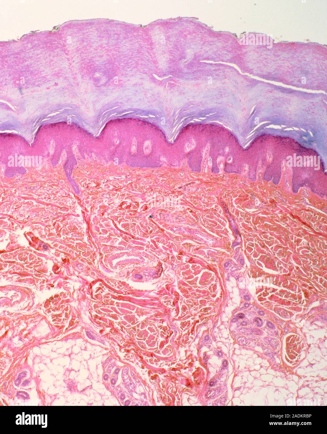 Light micrograph of a section through the skin of the finger. Four ...