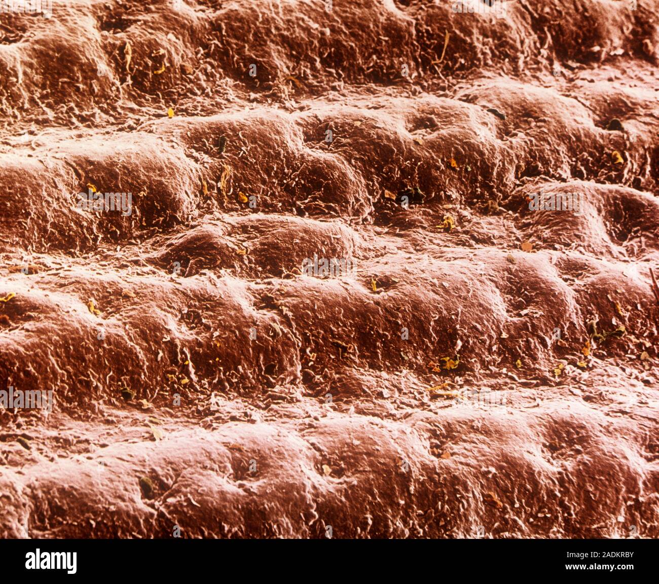 False-colour scanning electron micrograph of skin from the palm of the ...