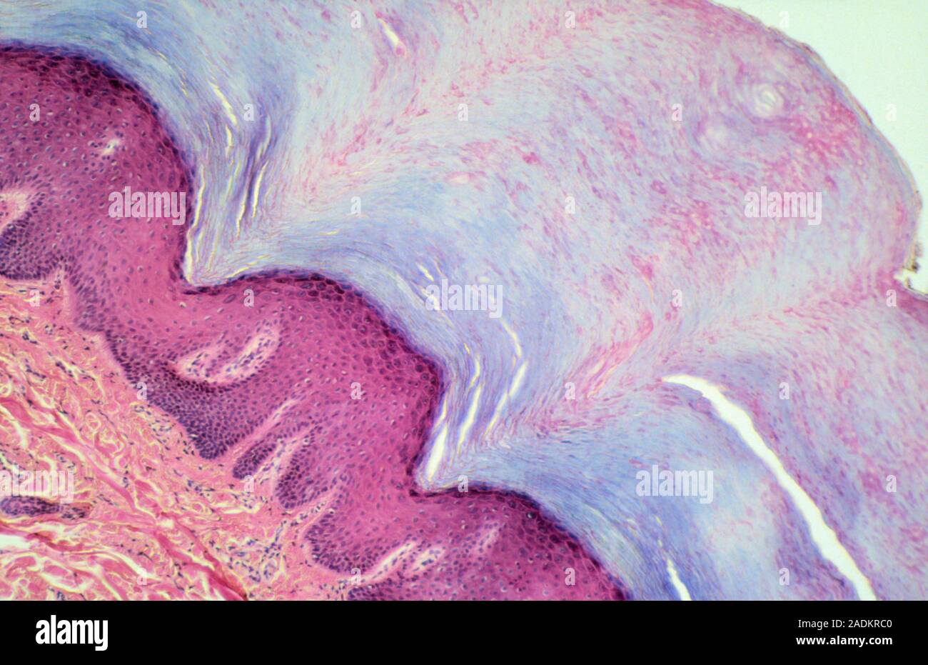 Light micrograph of the external layers of the skin of a finger. The ...