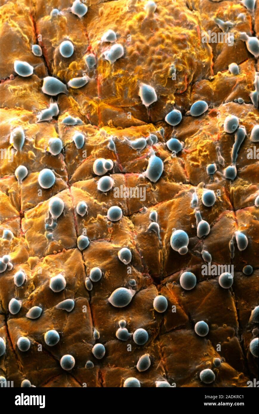 Skin with sweat droplets. Coloured scanning electron micrograph (SEM ...