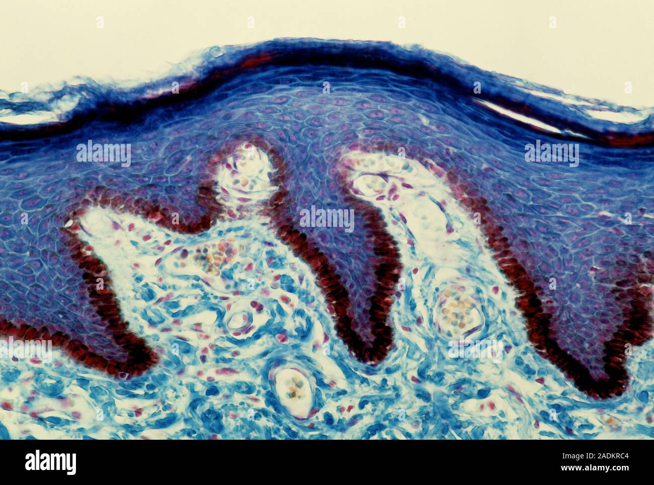 Skin of black African. Light micrograph of a section through black skin ...
