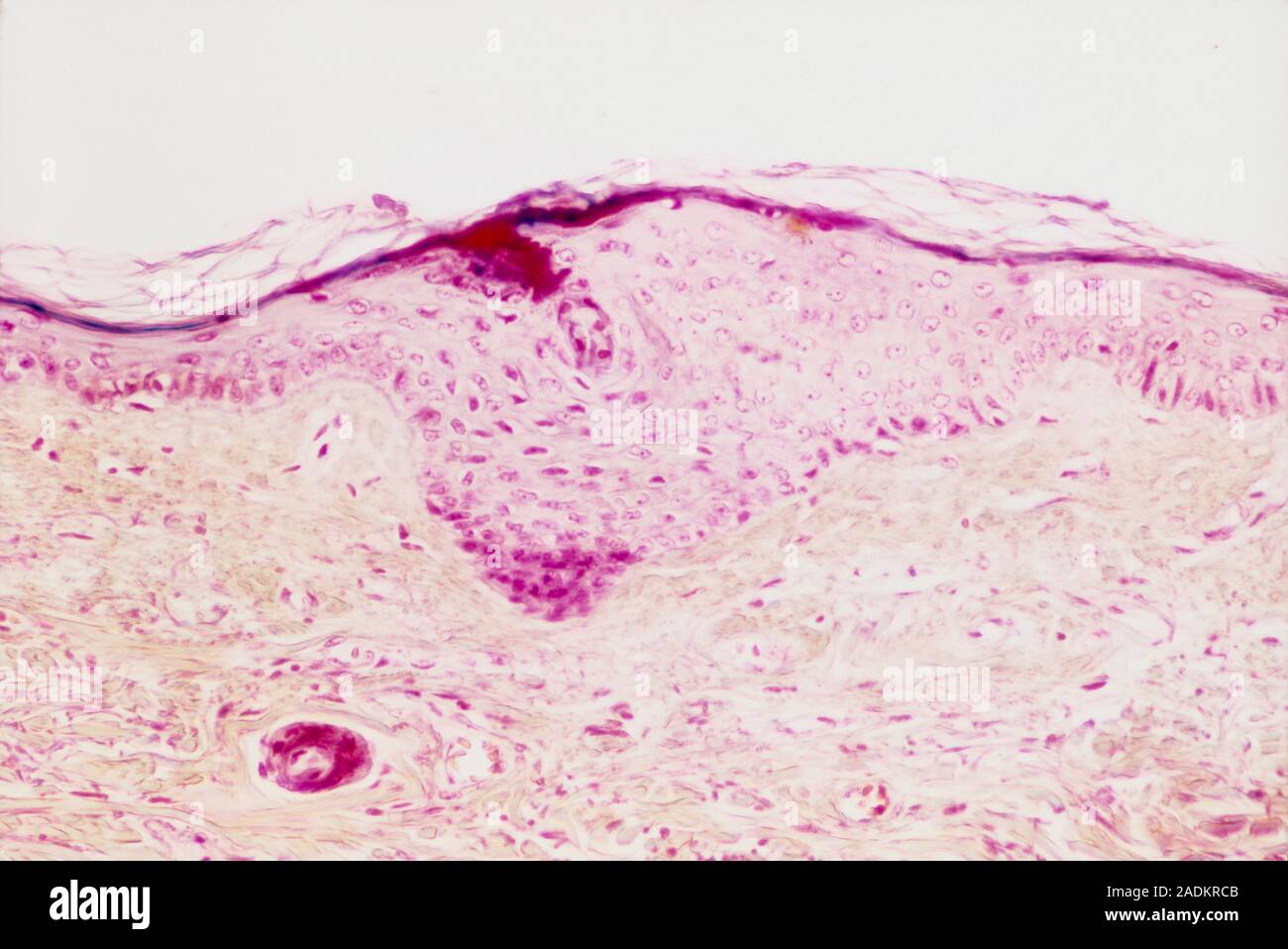 Human skin. Light micrograph of a section through human skin. The ...