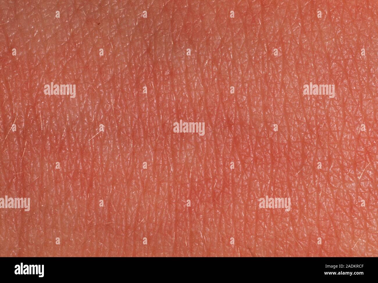 Normal skin. Close-up of an area of normal healthy skin on the wrist of ...