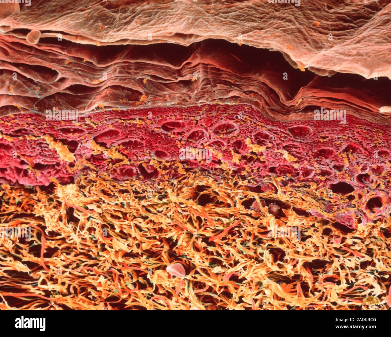 Skin. Coloured scanning electron micrograph of a section through the ...