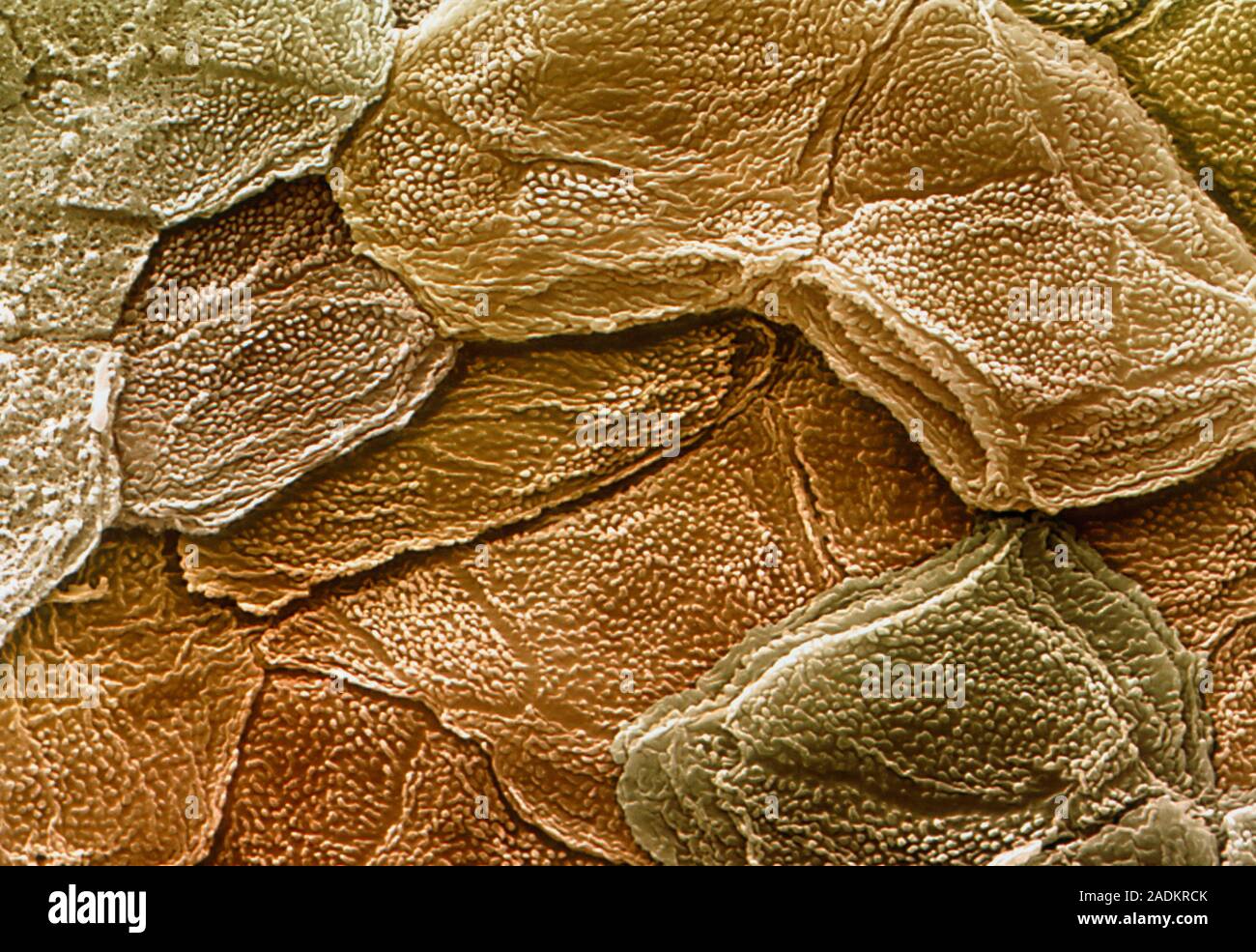 Human skin. Coloured scanning electron micrograph (SEM) of the surface ...
