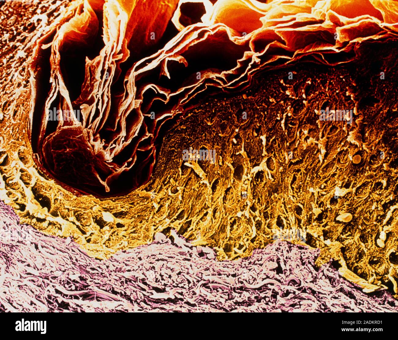 Skin. Coloured scanning electron micrograph of a section through human ...