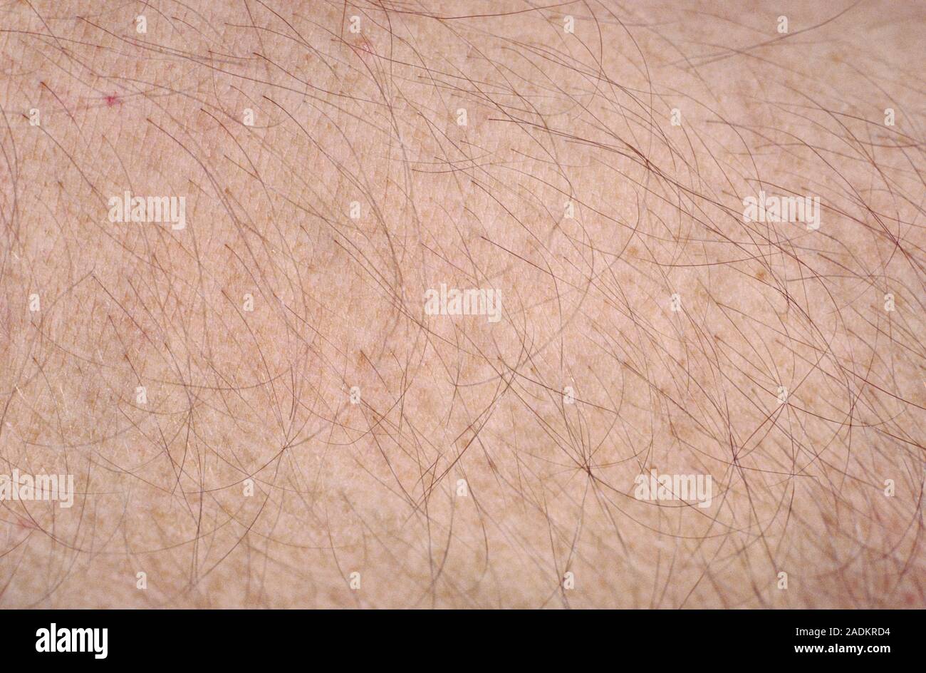 Human skin. View of the healthy skin of a man's arm. Hairs are seen ...