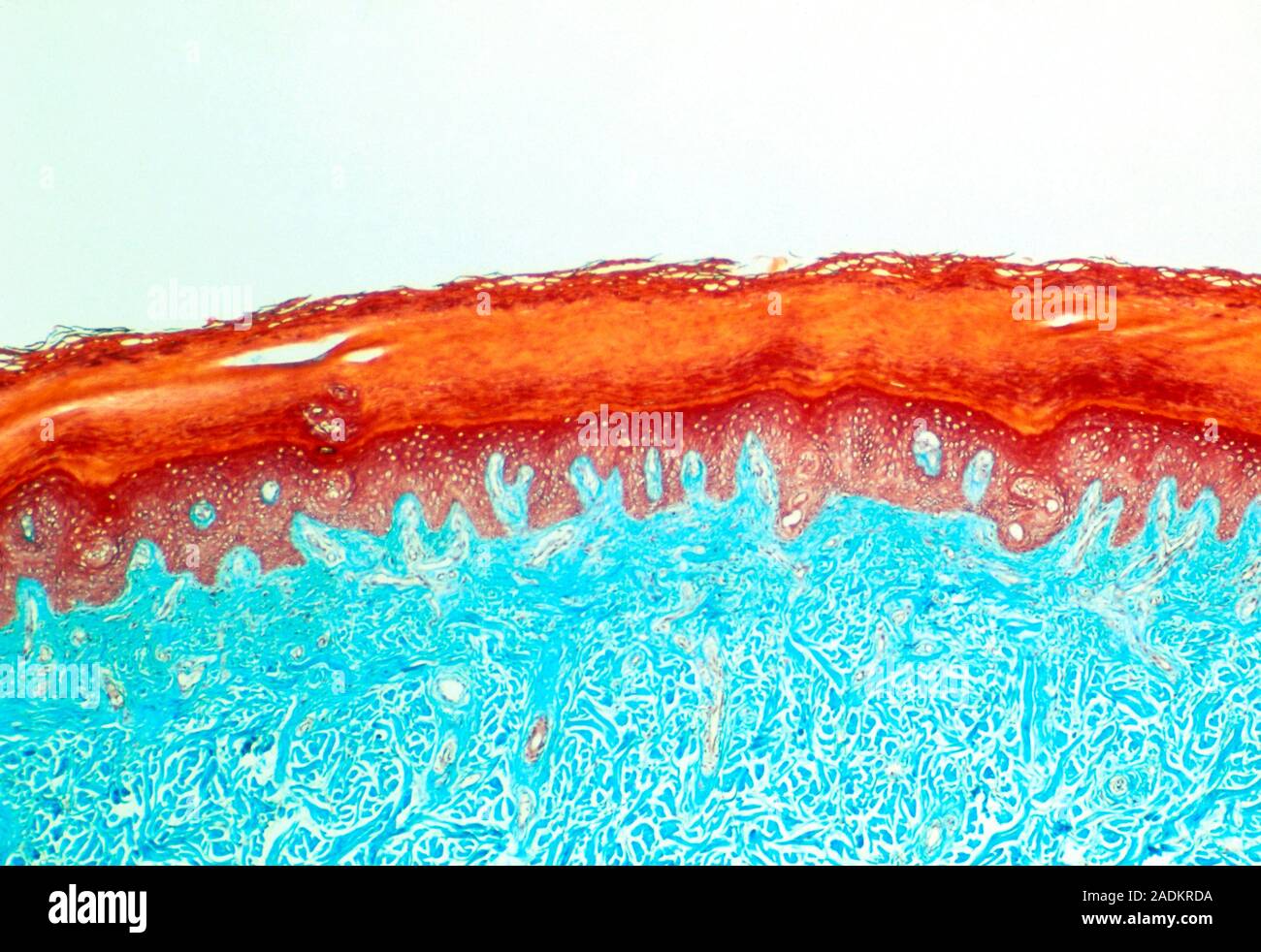 Skin. Light micrograph of a section through healthy human skin. The ...