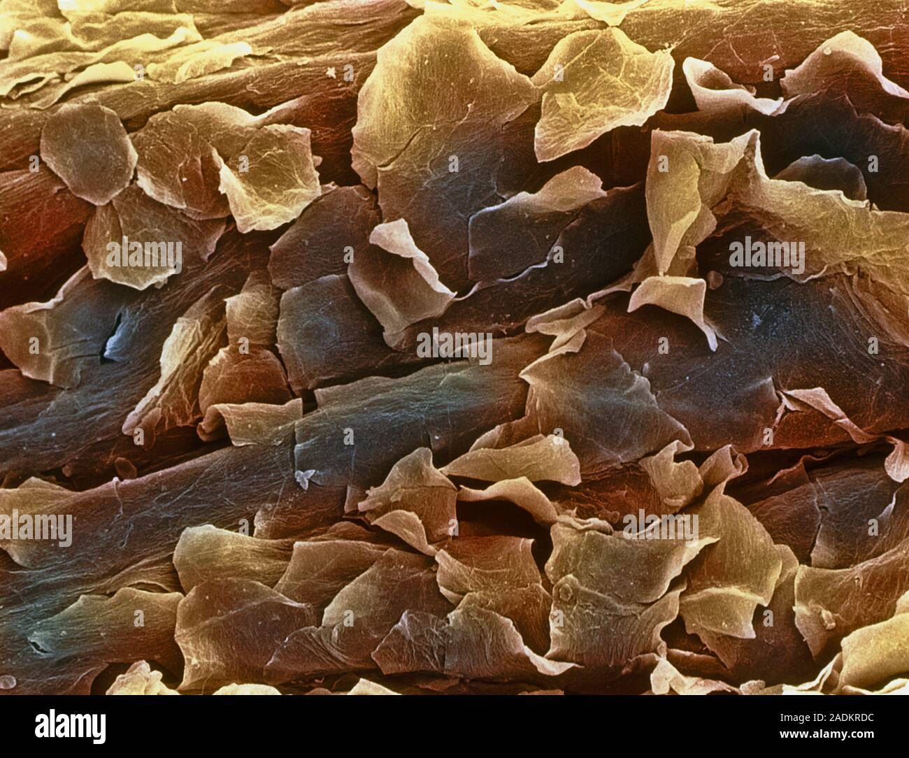 Human skin. Coloured scanning electron micrograph (SEM) of healthy ...