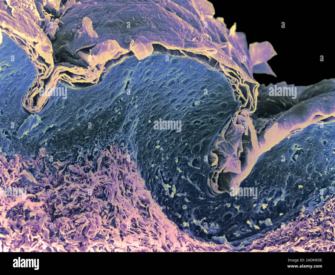 Skin. Coloured scanning electron micrograph (SEM) of a section through ...