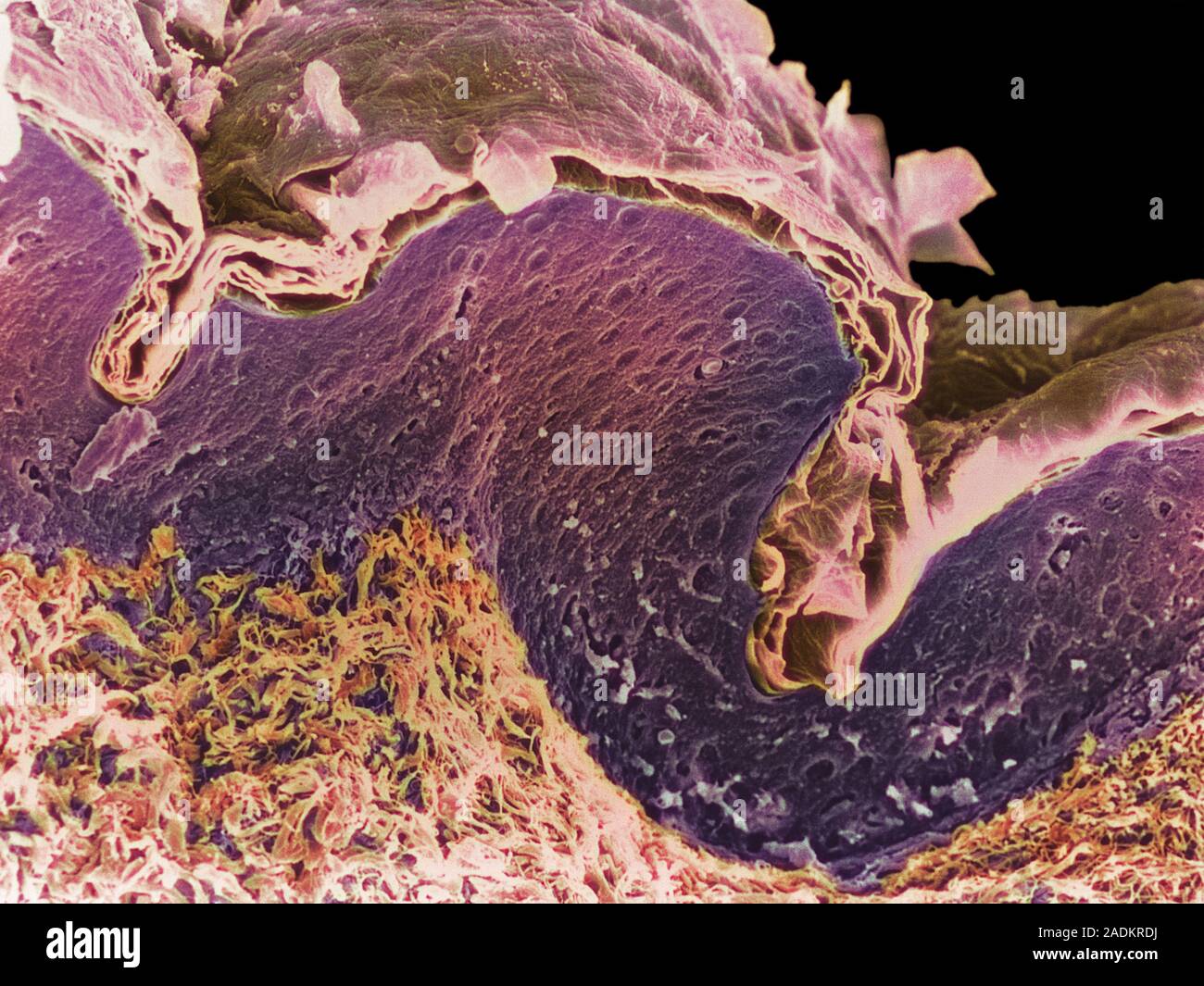 Skin. Coloured scanning electron micrograph (SEM) of a section through ...