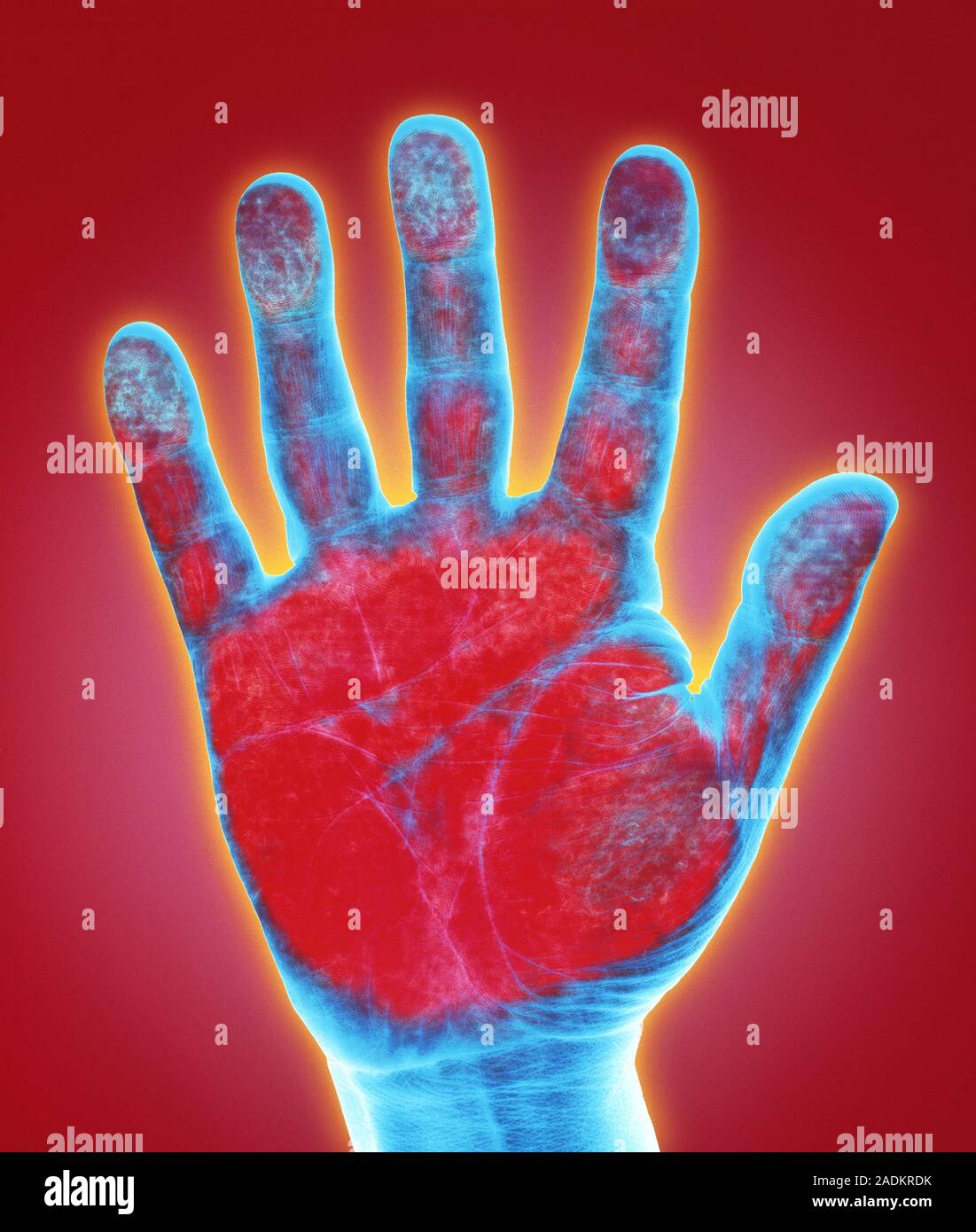 Hand Computer Enhanced Image Of A Healthy Human Hand Showing A Unique Pattern Of Skin Ridges On