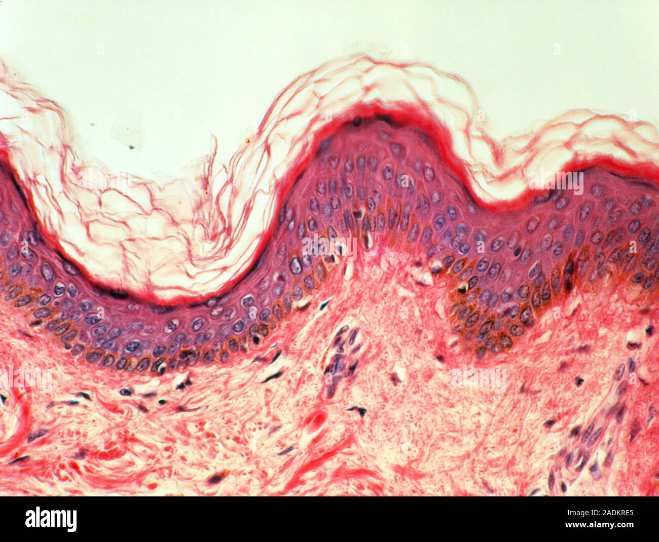Skin. Light micrograph of a section through the skin from an armpit ...