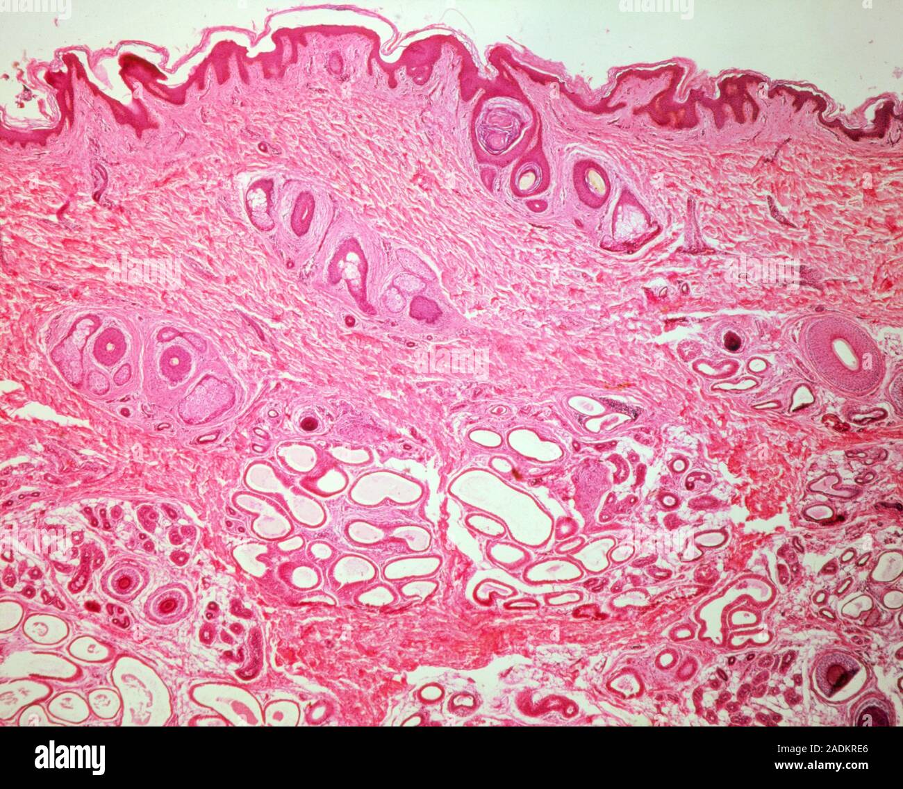 Skin. Light micrograph of a section through the skin from an armpit ...