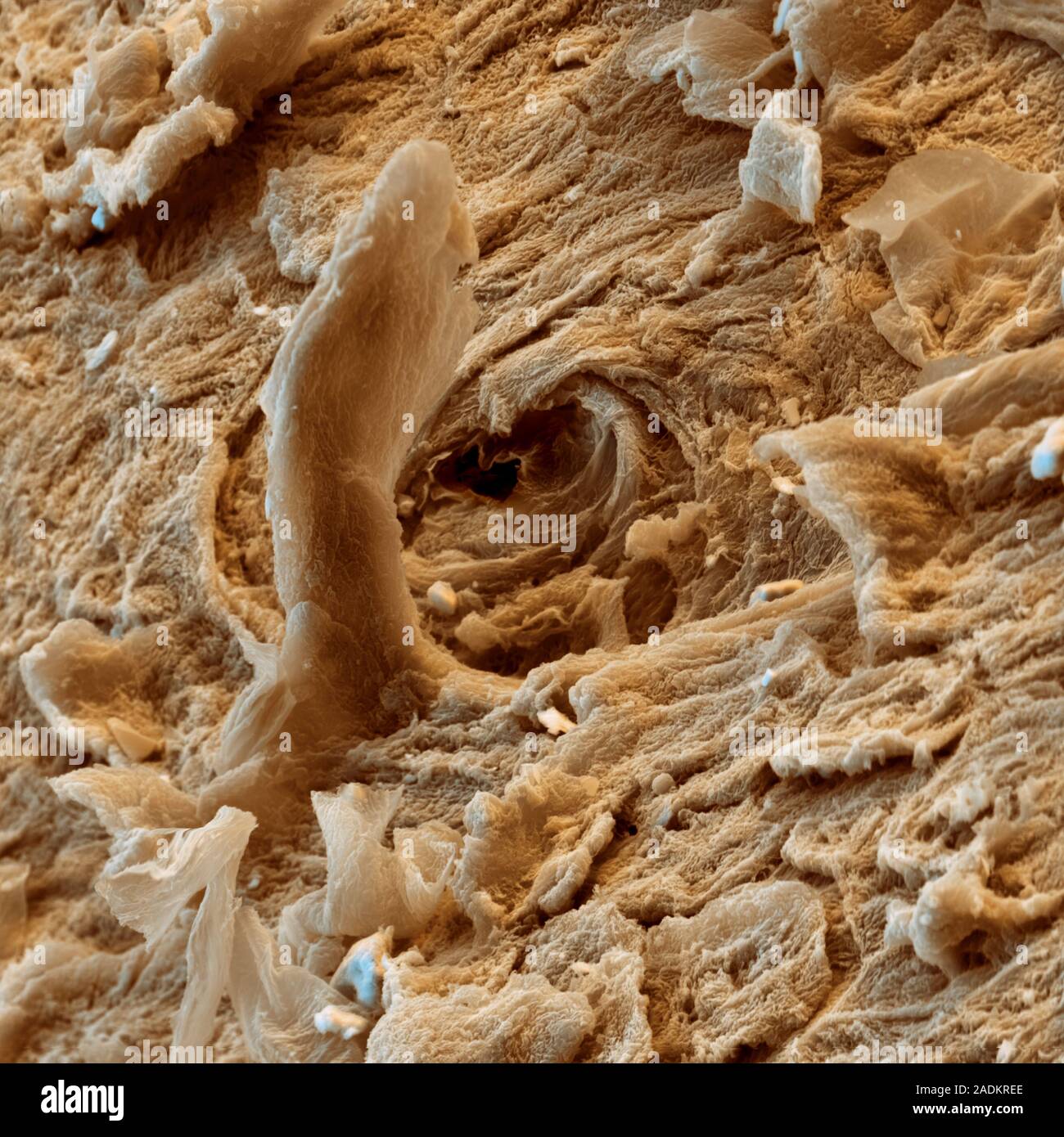 Skin. Coloured scanning electron micrograph (SEM) of skin on the tip of ...