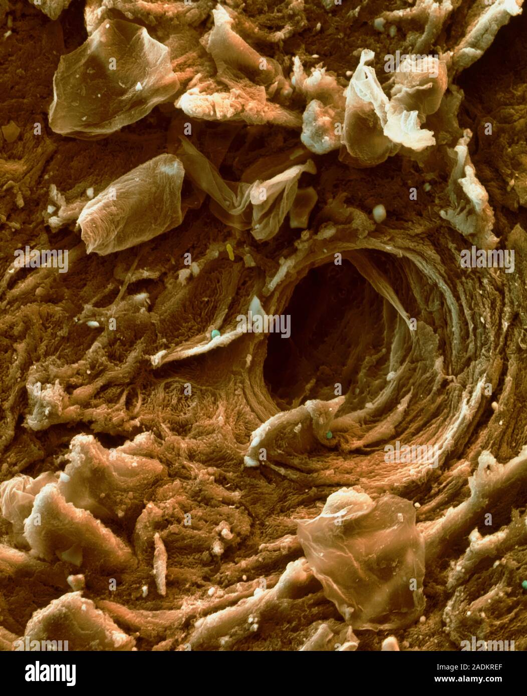 Skin. Coloured scanning electron micrograph (SEM) of skin on the tip of ...