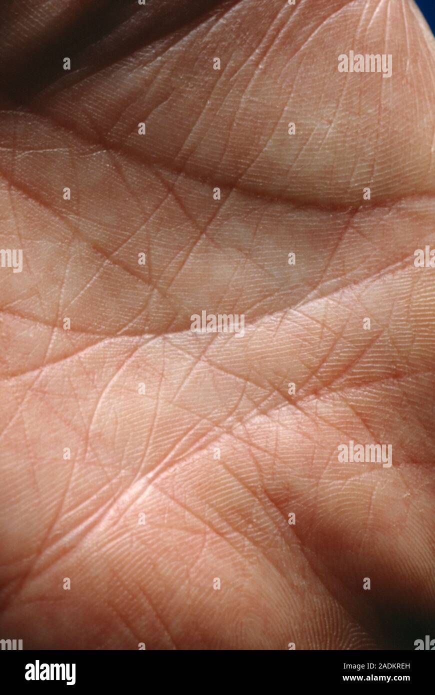 Skin of the palm of a human hand Stock Photo - Alamy