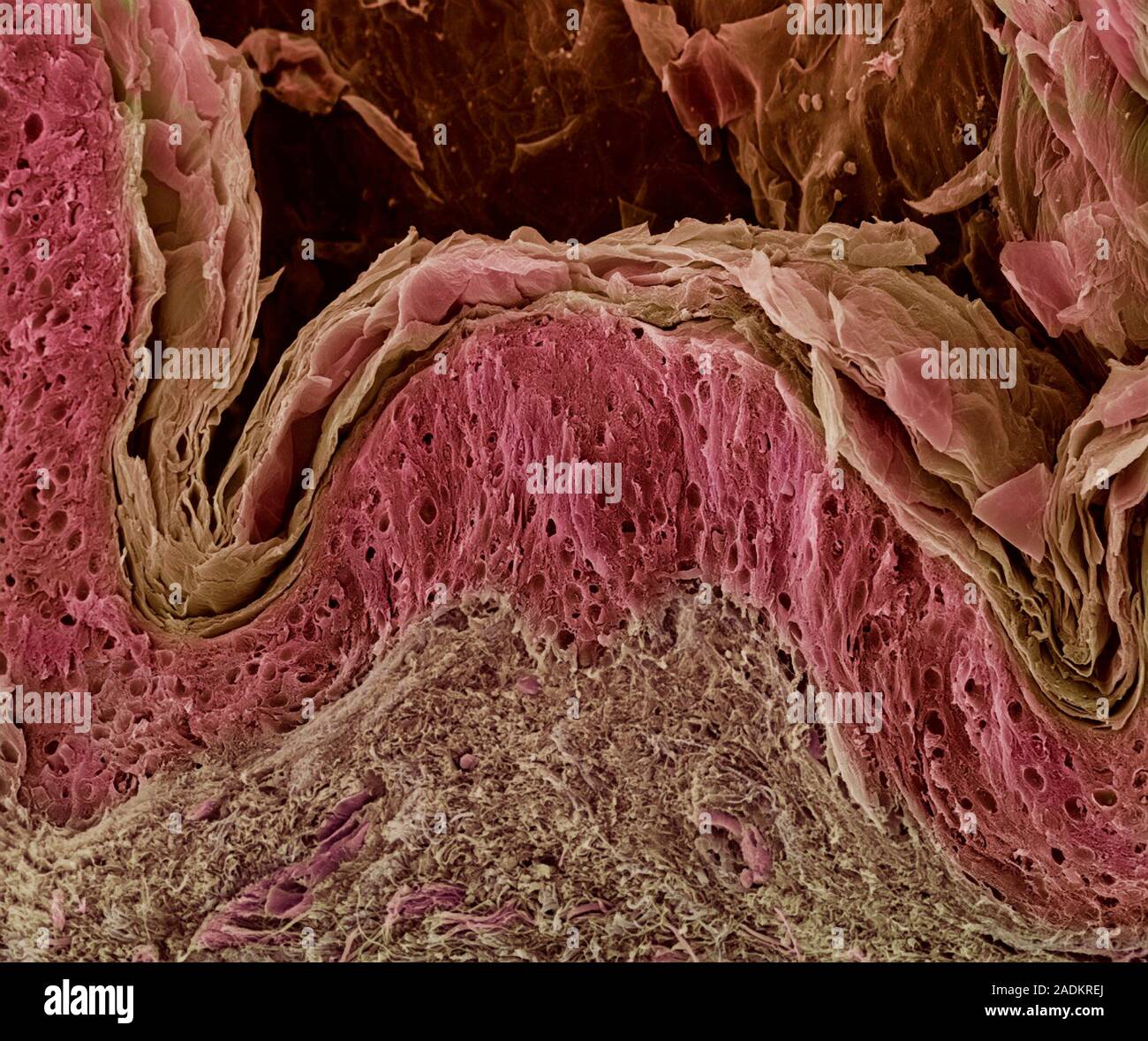 Skin. Coloured scanning electron micrograph (SEM) of freeze-fractured ...