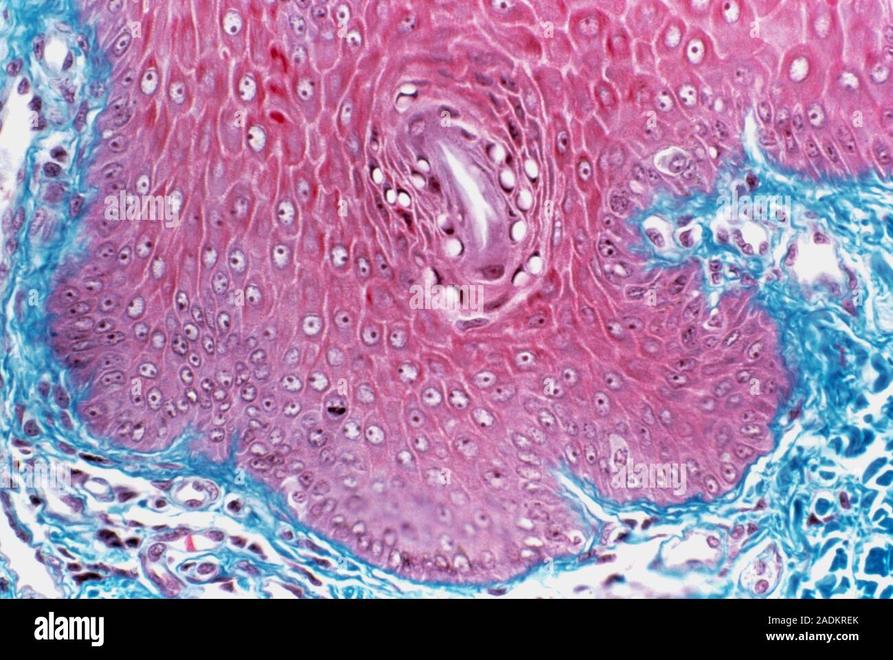 Sweat duct in skin. Light micrograph of a section through the epidermis ...
