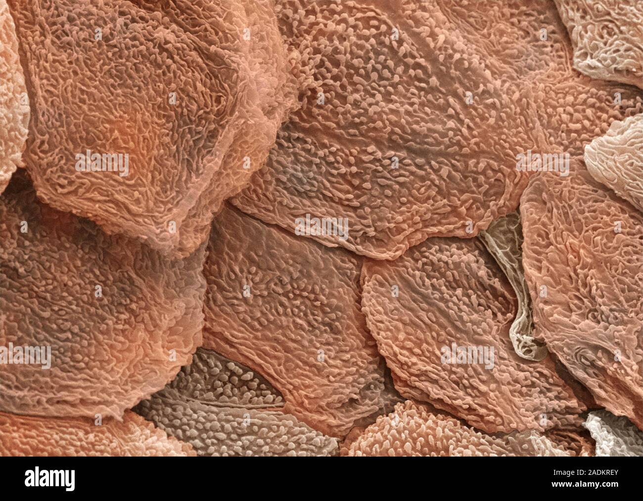 Human skin. Coloured scanning electron micrograph (SEM) of the surface ...