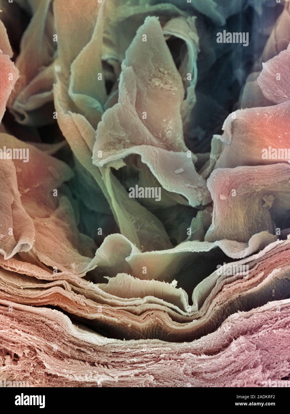 Skin surface. Coloured scanning electron micrograph (SEM) of a section ...