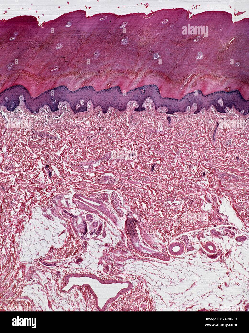 Sole skin. Light micrograph of a section through the skin of the sole ...