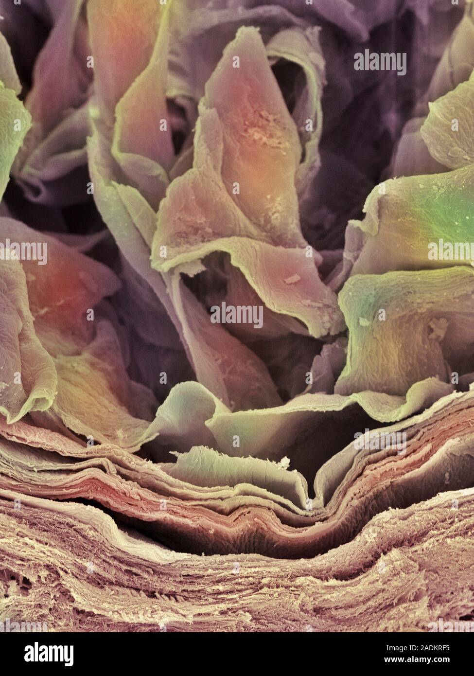 Skin surface. Coloured scanning electron micrograph (SEM) of a section ...