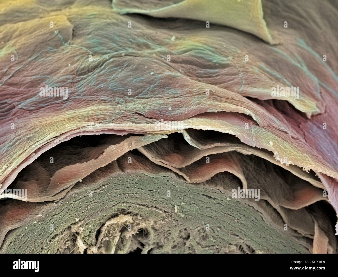 Skin layers. Coloured scanning electron micrograph (SEM) of a freeze ...