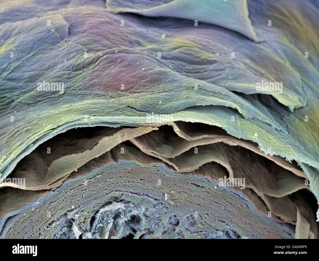 Skin layers. Coloured scanning electron micrograph (SEM) of a freeze-fractured section through ...
