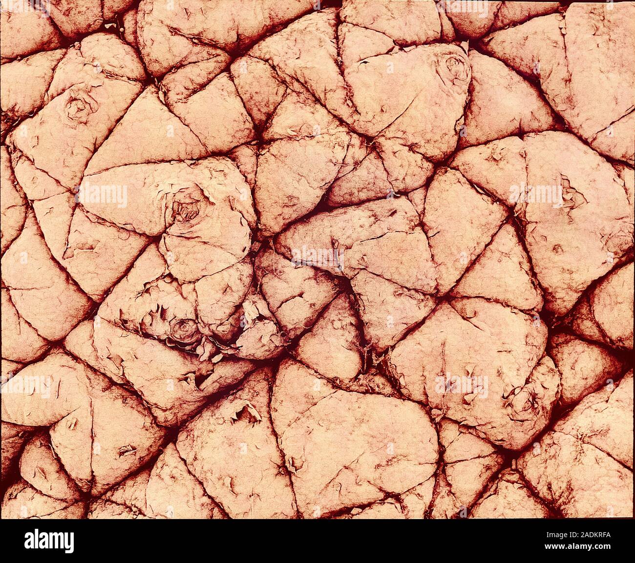 Human skin. Coloured scanning electron micrograph (SEM) of the surface ...