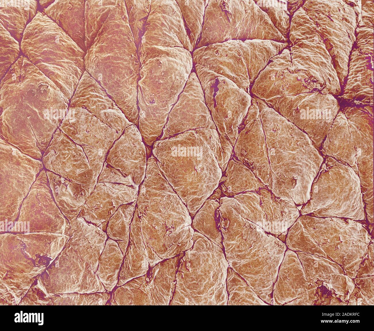 Human skin. Coloured scanning electron micrograph (SEM) of the surface ...
