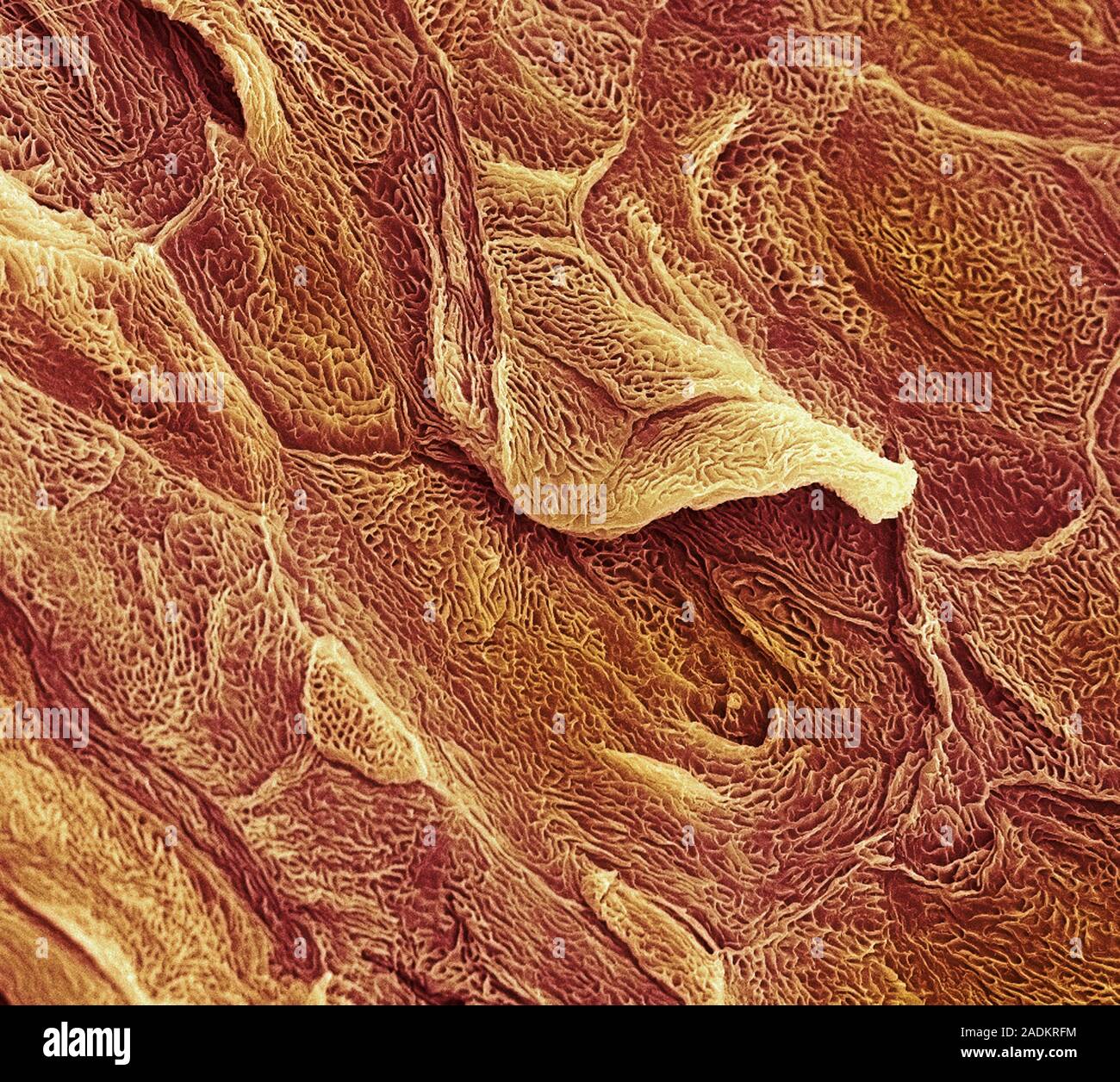 Skin surface. Coloured scanning electron micrograph (SEM) of dead cells ...