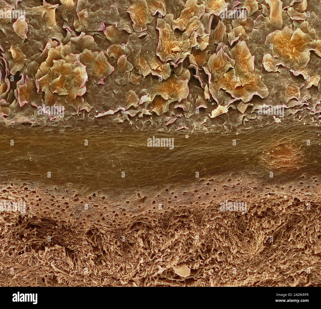 Skin. Coloured scanning electron micrograph (SEM) of a section through ...