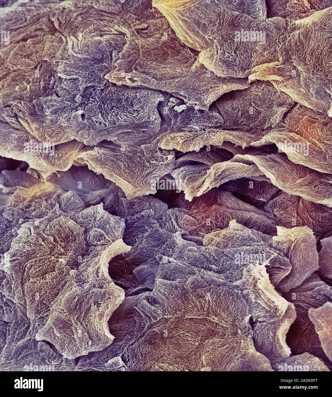 Skin surface. Coloured scanning electron micrograph (SEM) of dead cells ...