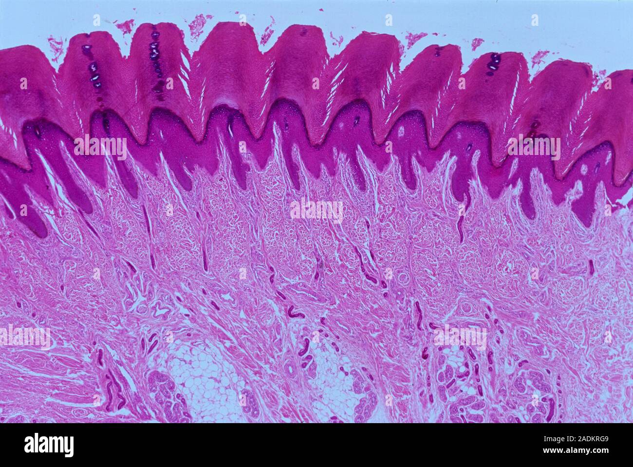 Palm of hand. Light micrograph of a section through human skin from the ...