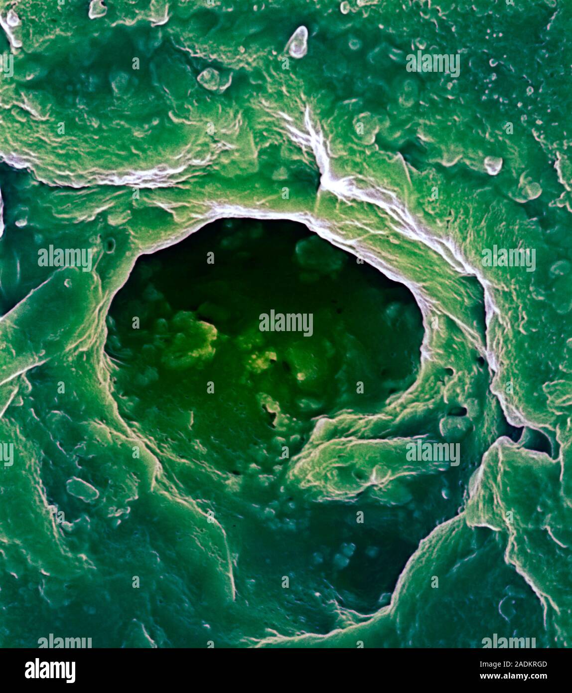 Sweat pore. Coloured scanning electron micrograph (SEM) of a sweat ...