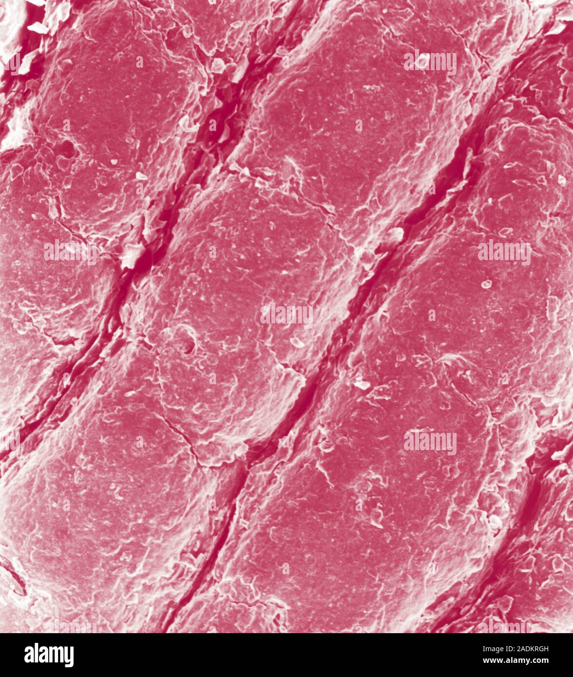 Human skin surface, coloured scanning electron micrograph (SEM). The ...