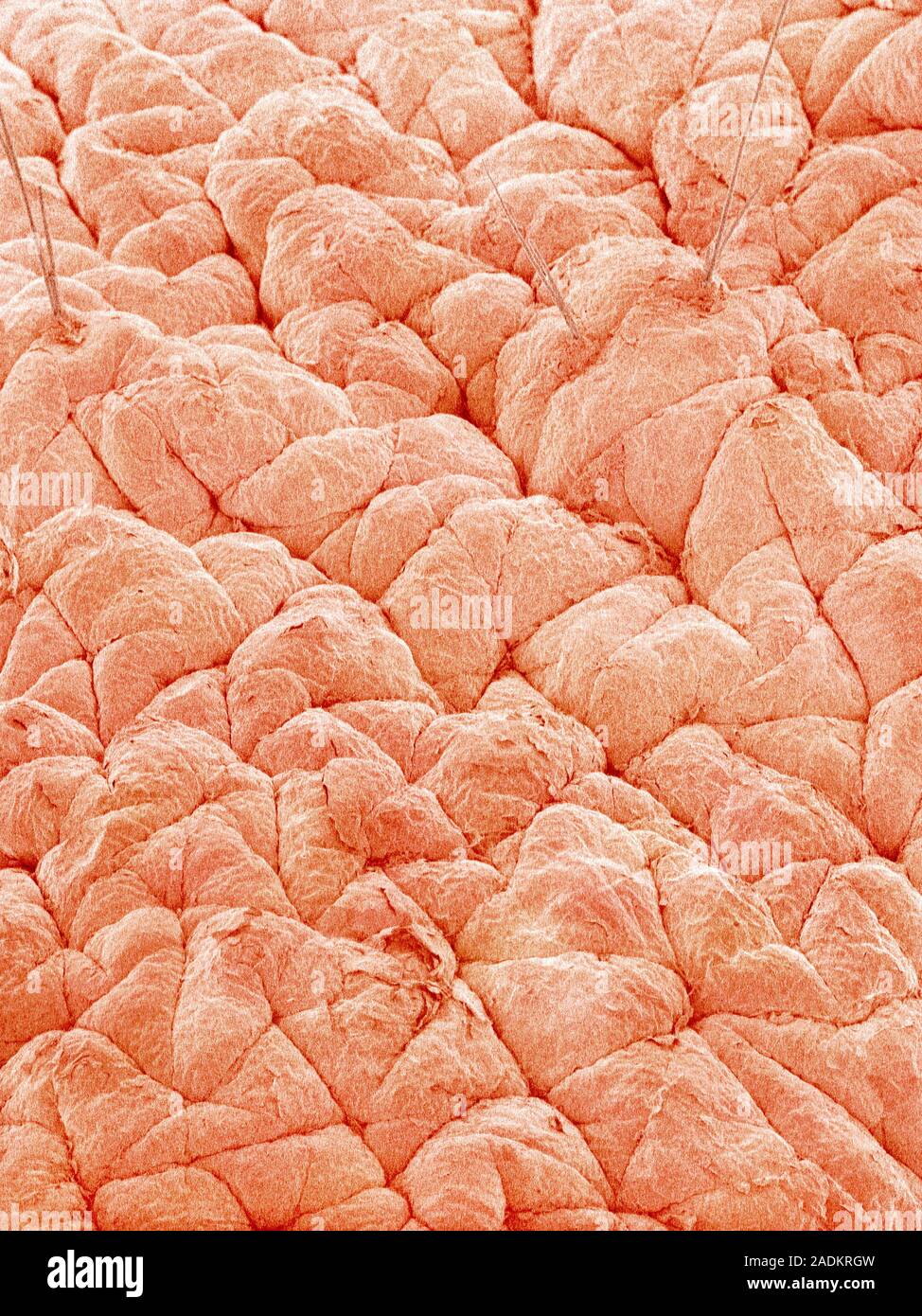 Human skin. Coloured scanning electron micrograph (SEM) of the ...