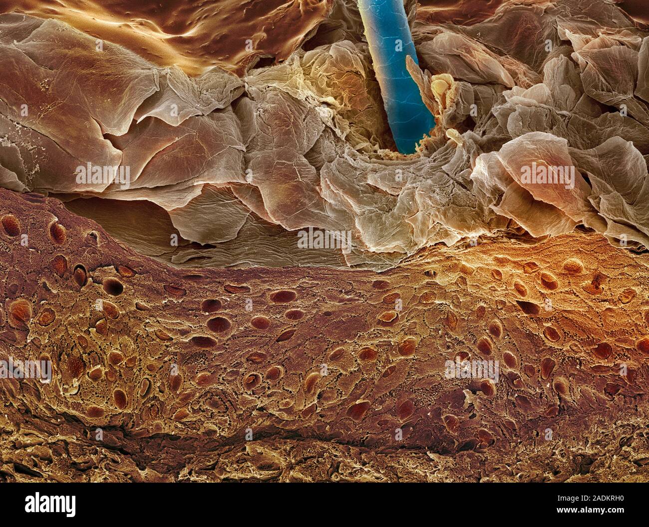 Skin section. Coloured scanning electron micrograph (SEM) of a section ...