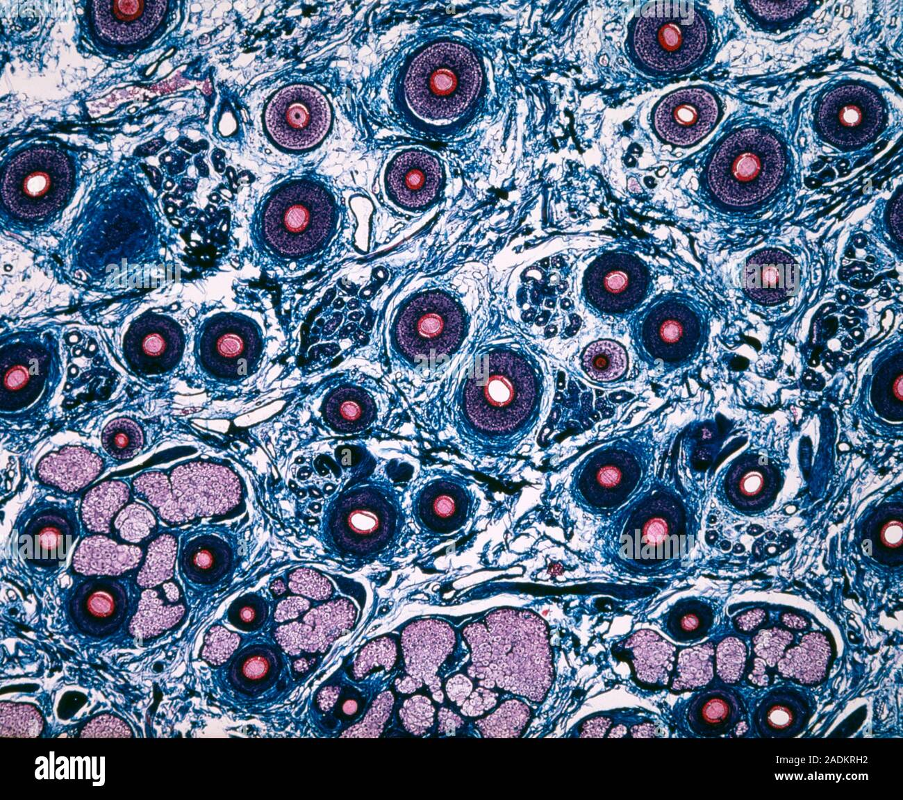Skin section. Light micrograph of a section through the dermis of the ...