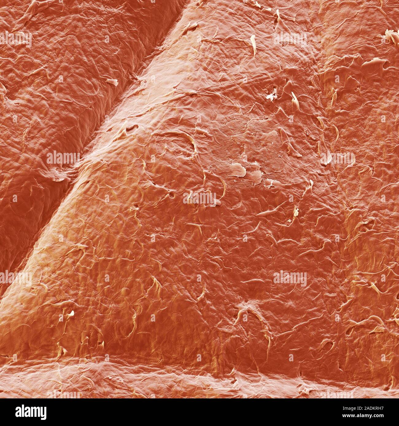 Dry skin. Coloured scanning electron micrograph (SEM) of dry skin from ...